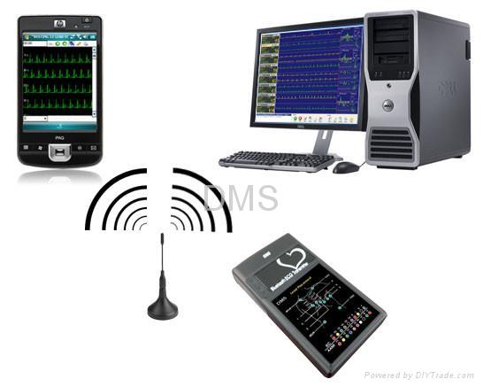 DMS Telemetry ECG Monitoring System - TDA3.0 (China Manufacturer ...