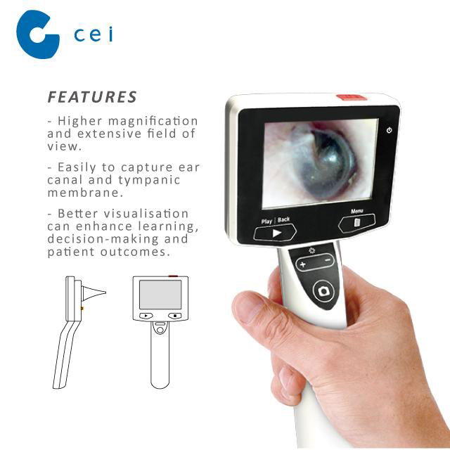 OEM ODM Veterinary Otoscope Digital Otoscope Camera Otitis Media ...