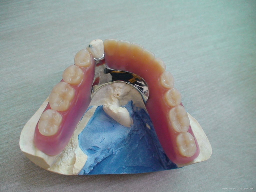 Partial Denture / RPD - 4.1 - Sunflower Dental (China Manufacturer ...