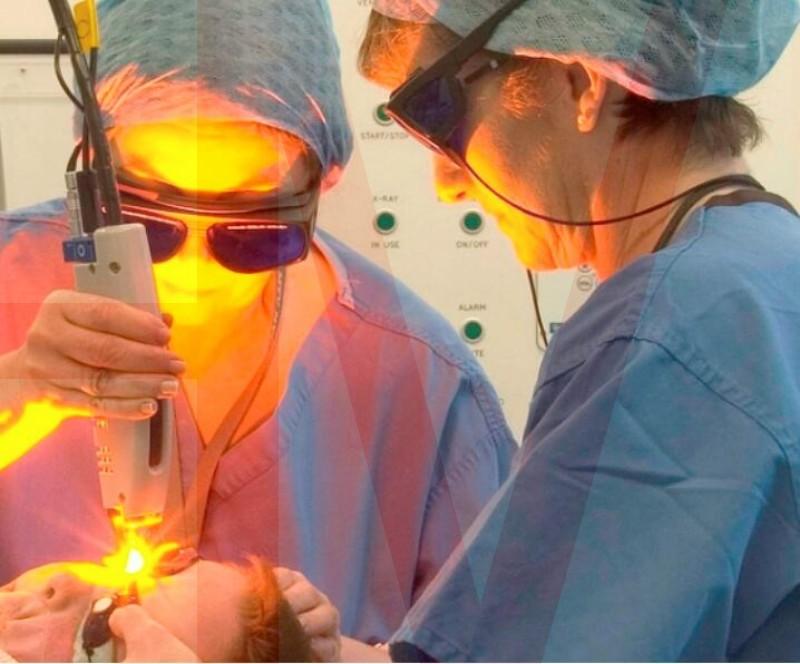 Lensed fiber optic fiber angle polishing - Customized - 3V-TECH (China ...