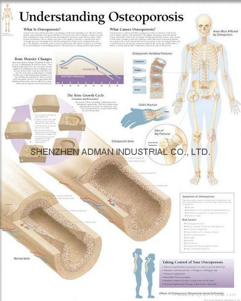 UNDERSTANDING THE PROSTATE--3D RELIEF WALL MEDICAL/PHARMA CHART/POSTER ...