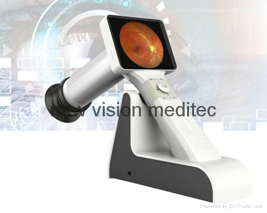 Digital Portable Retinal Camera/ fundus camera - Non-mydriatic (China ...