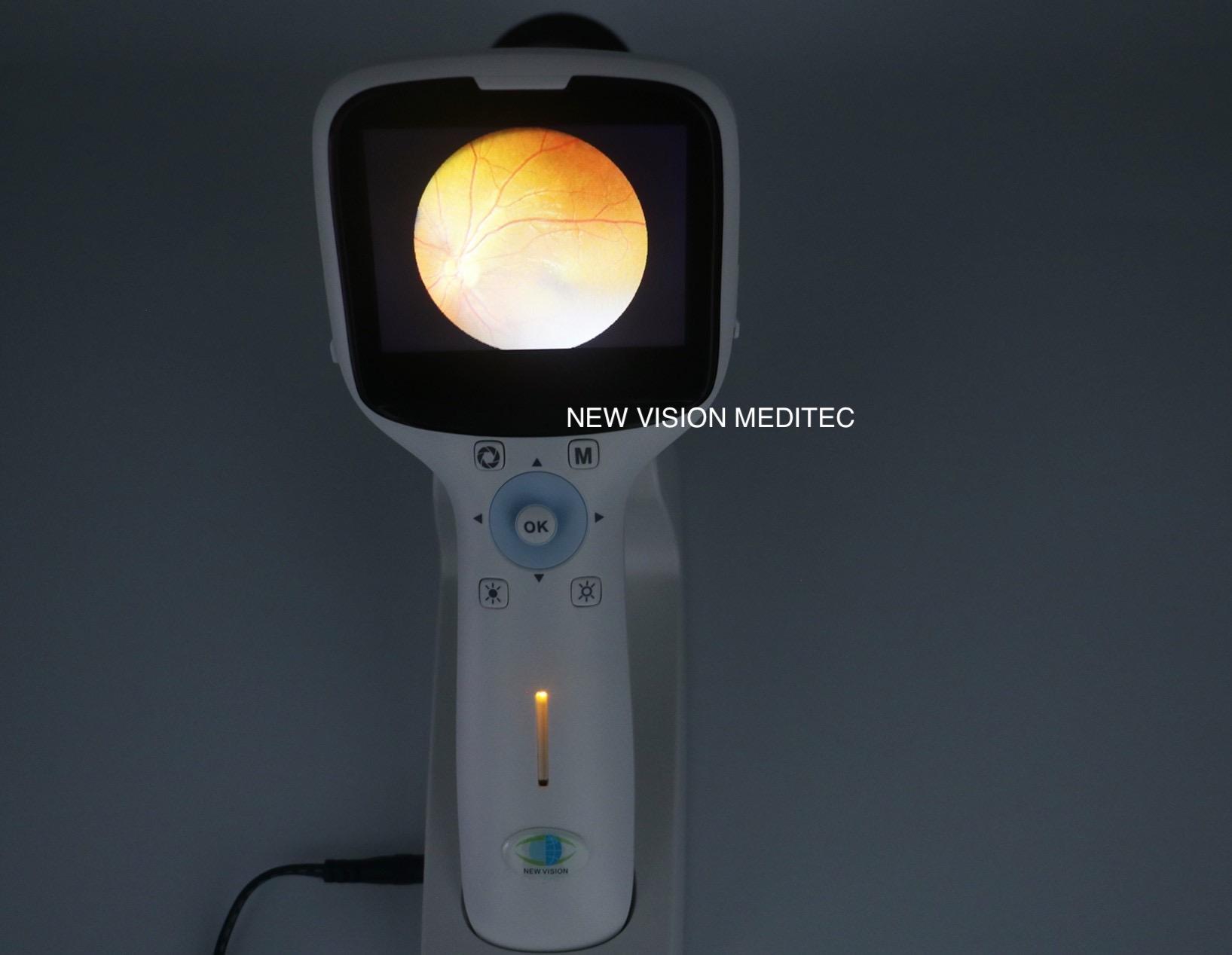 Digital Portable Retinal Camera/ fundus camera - Non-mydriatic - NEW ...