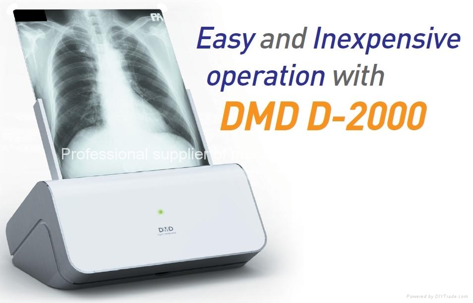 Digital x-ray Film Scanner (Digitizer) (Korea Manufacturer) - Other ...