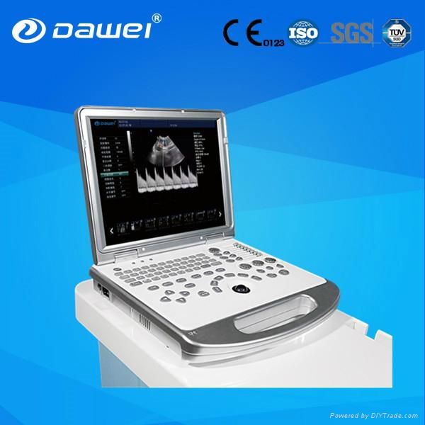 laptop color doppler ultrasound scanner DW-C60 PLUS - Dawei (China ...