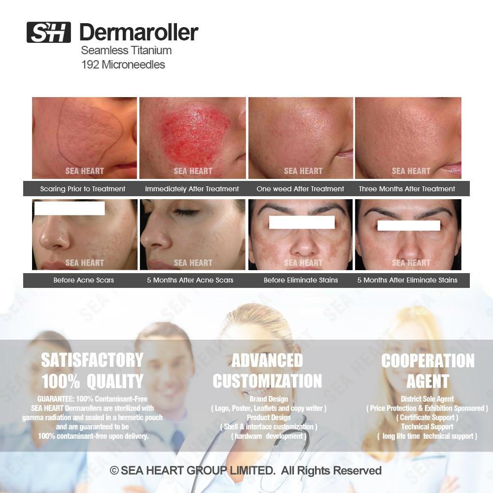 1.5 mm 192 titanium microneedle roller zgts derma roller for skin ...