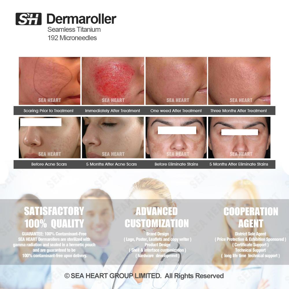 Microneedle Therapy System MTS titanium derma roller 192 zgts - SH-DR ...