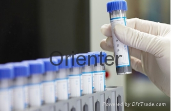 Body Fluid Testing Automated Stool Analysis and Processing for stool ...