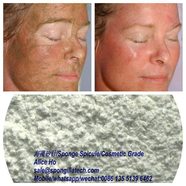 Cosmetic Materia Fresh Water Spongilla Needle Sponge Needle for Skin ...