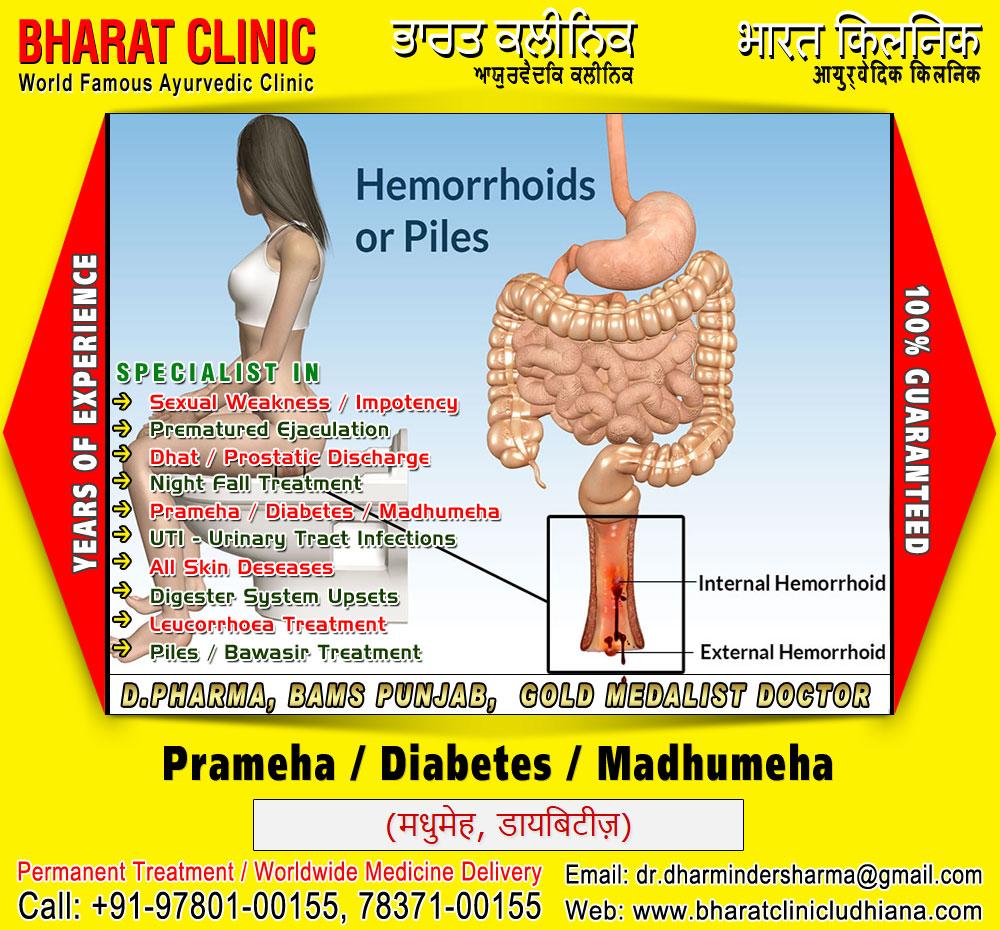 Bawasir Ayurvedic Medicine - BHARAT CLINIC (India Services or Others ...
