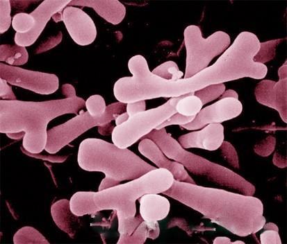 Probiotics Bifidobacterium bifidum - Asia - Master of Probiotics from