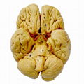 Whole Brain Plastination Specimen for Plastination Musuem - MW-009 ...