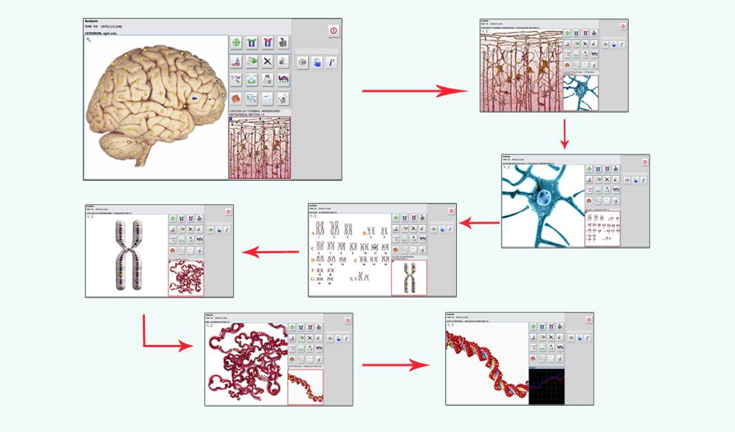 Metatron Hunter 4025 Bioresonance Machine - BR-05-2 - Singularity ...