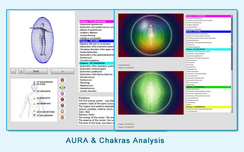 Bioplasm NLS Bioresonance Machine - Singularity (China Trading Company ...