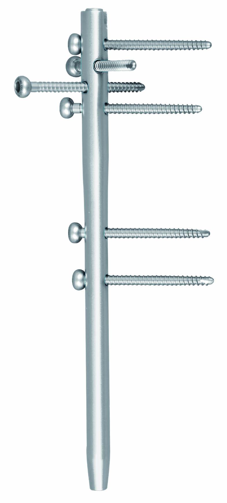 Humeral interlocking intramedullary nail - 9501 - Best Medical (China ...