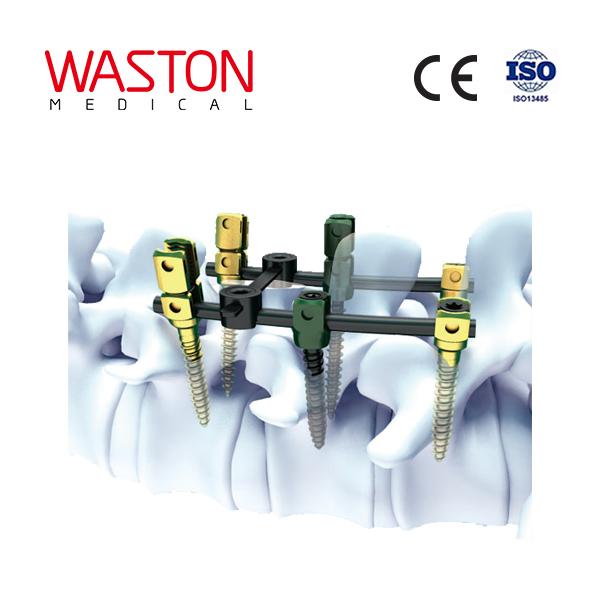 Minimally Invasive Spinal Trauma CE Master 9 Spinal SystemTitanium Alloy - 15034 - WASTON (China ...