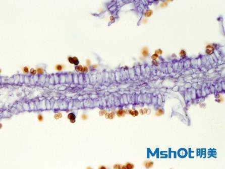 Routine biological microscope with trinocular observation tube ML31 ...