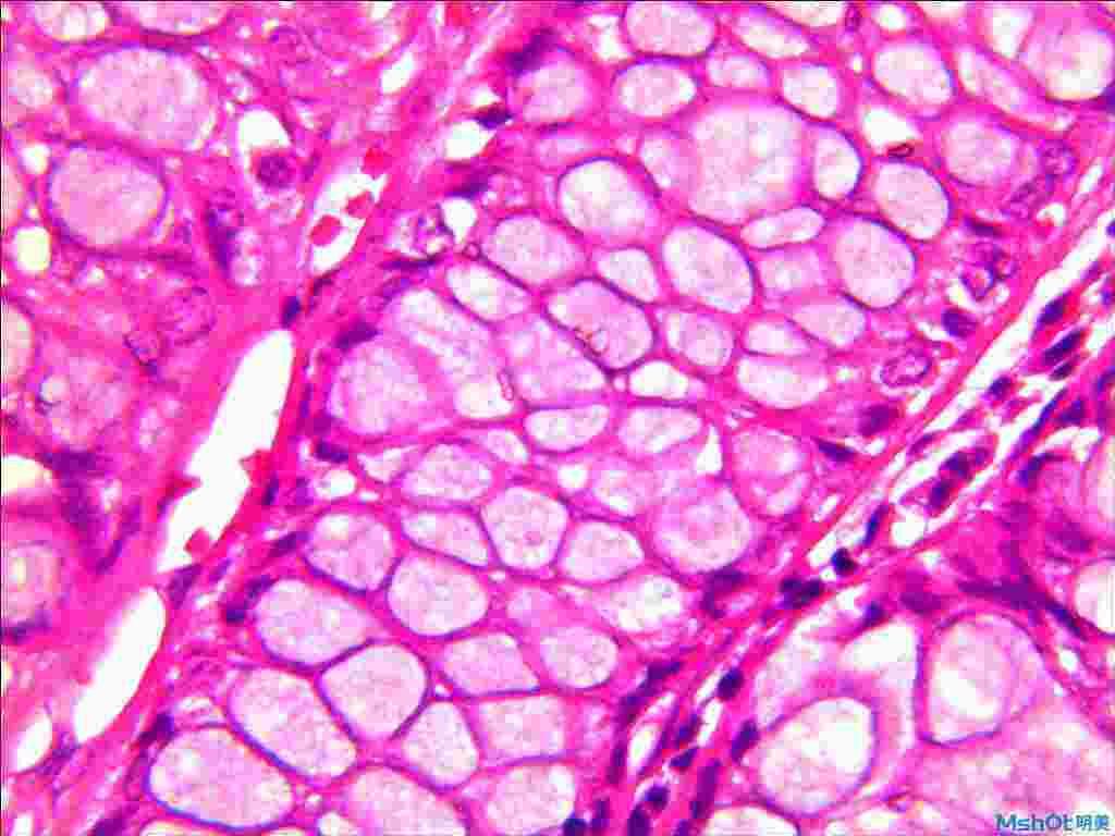 Routine biological microscope with trinocular observation tube ML31 ...