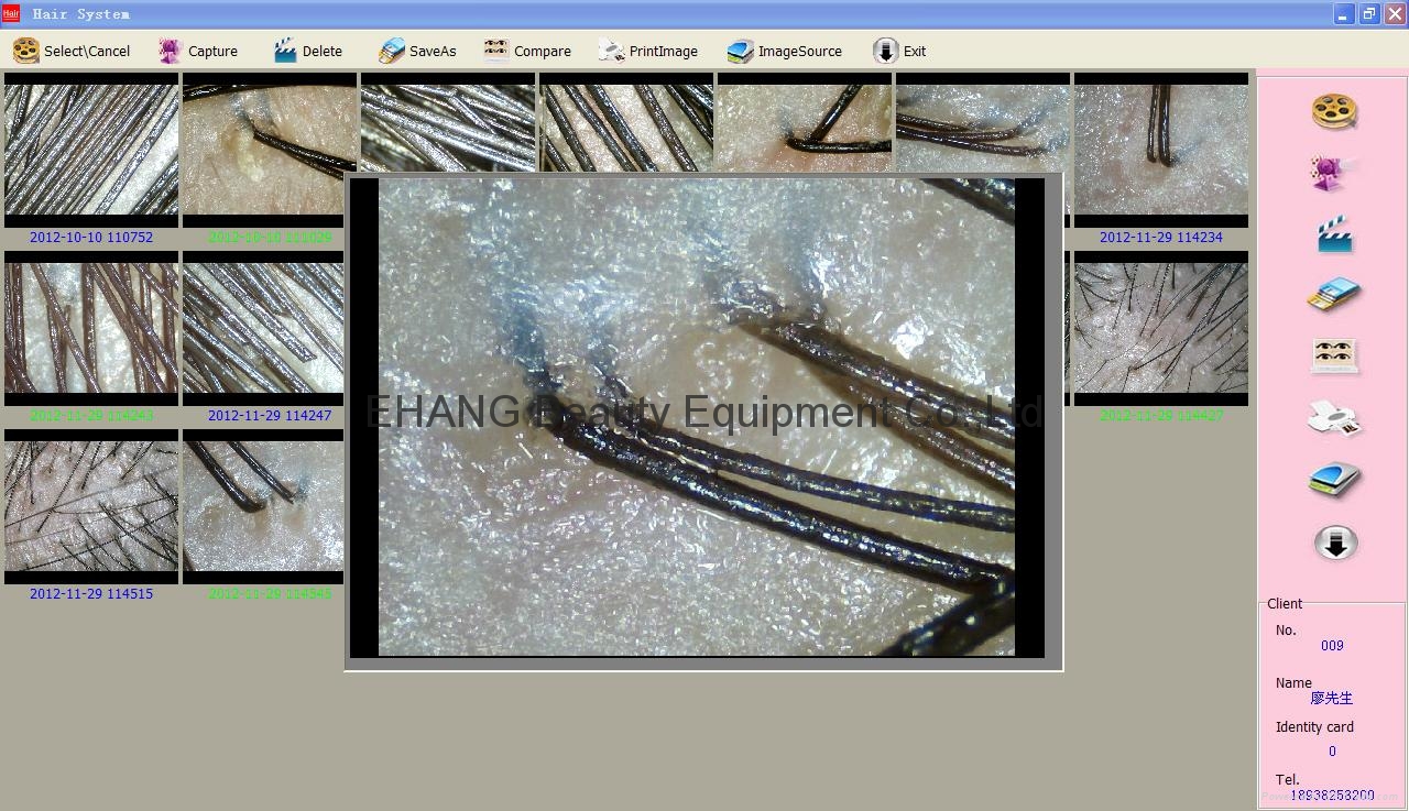 NEW 5.0 MP High Resolution USB Hair Scope,Hair Diagnosis,Hair & Beauty ...