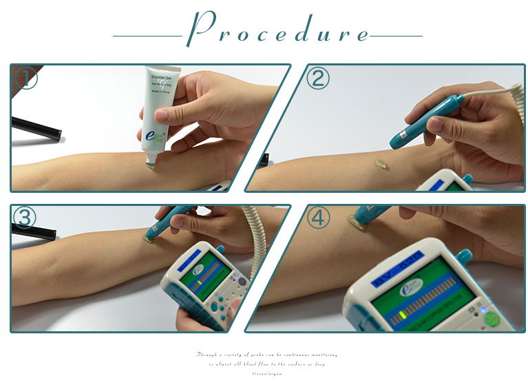 Home Use Vascular Blood Flow Detector, Blood Velocity Waveform Scander ...