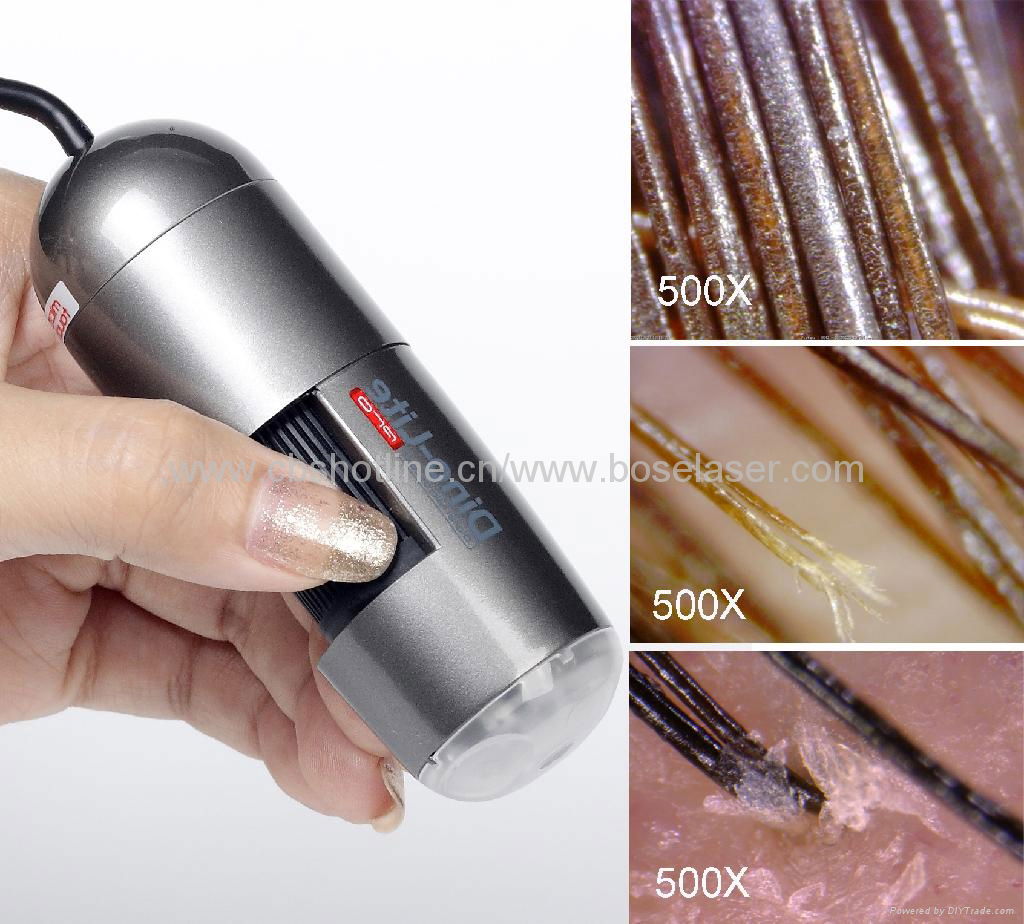 500X Scalp bacteria scope（2.0M pixels） - CBS-605 - CBS (China ...