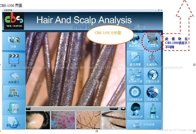 10X-200X Hair and Scalp Camera（1.3 pixels） - CBS-603 - CBSHOTLINE ...